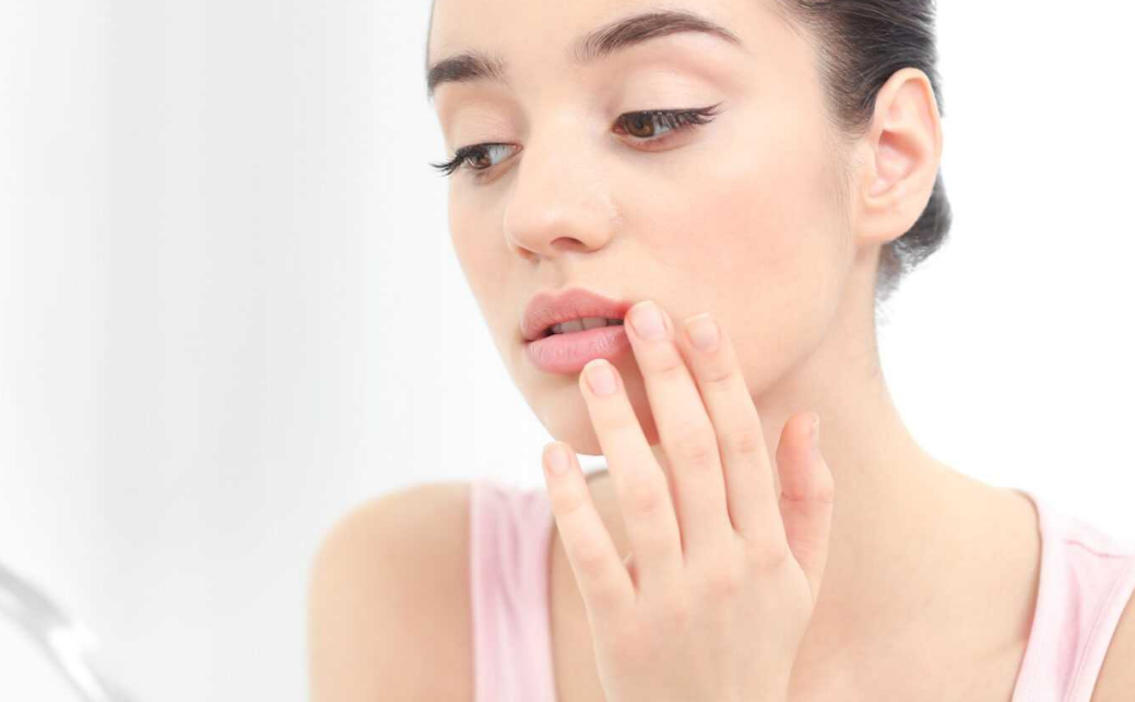 Cold Sores: The Dos and Don’ts | Aussie Pharmacy